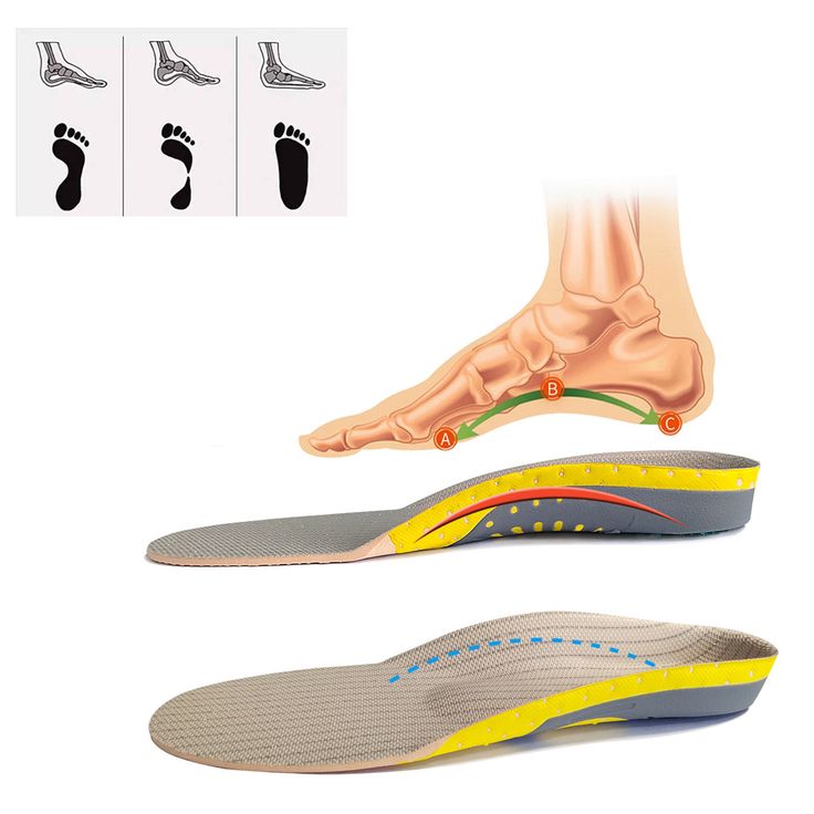 Choosing the Right Orthopedic Insoles for Your Feet – A Complete Guide