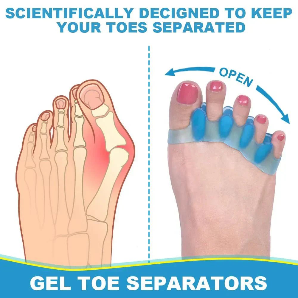 Step Into Comfort: Why Soft Silicone Toe Orthotics Are a Game Changer