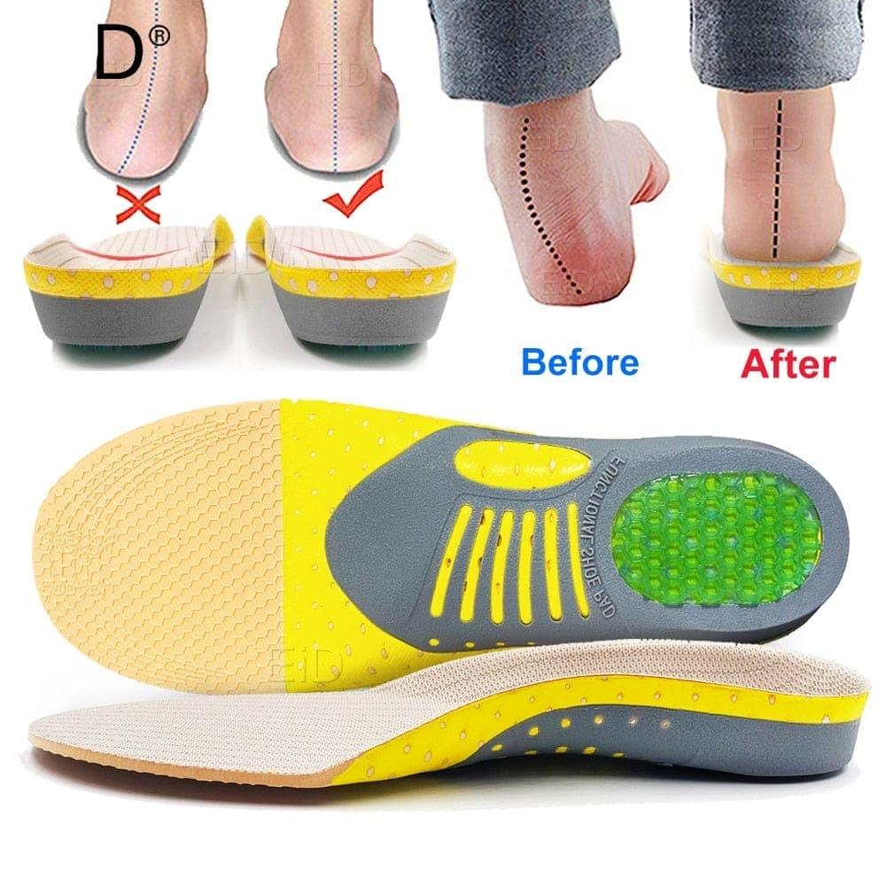 The Ultimate Guide to Orthopedic Insoles in the UK – What They Are, Ho