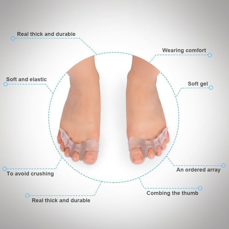 Why I Started Wearing Silicone Toe Orthotics During Yoga—and Never Loo